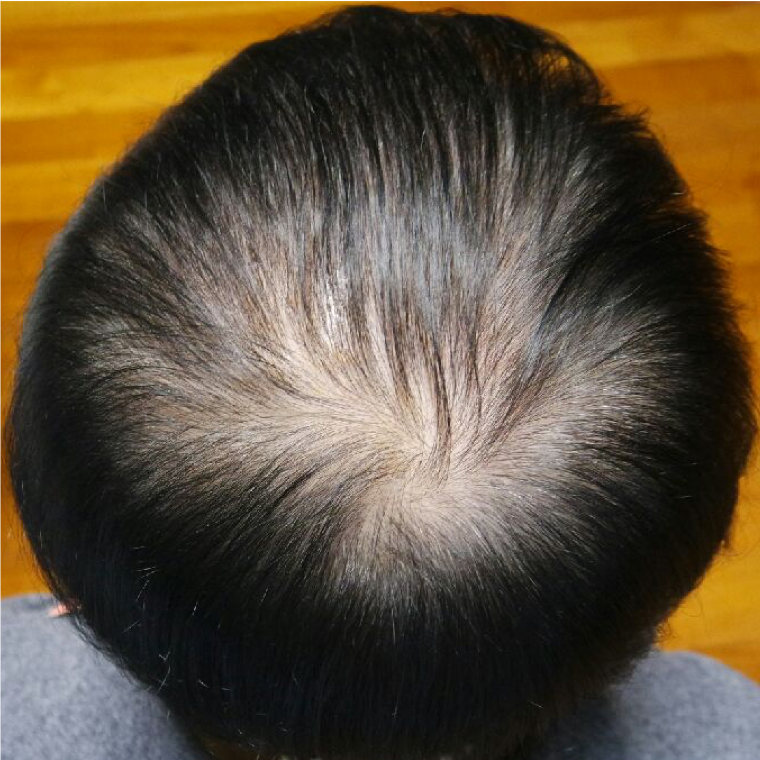 ProCell Therapeutics, Inc