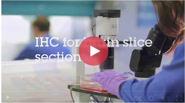 IHC for brain slice sections video protocol : Abcam 제품 소개