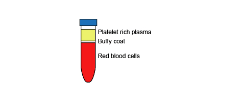 Isolation of human platelets from whole blood : Abcam 제품 소개