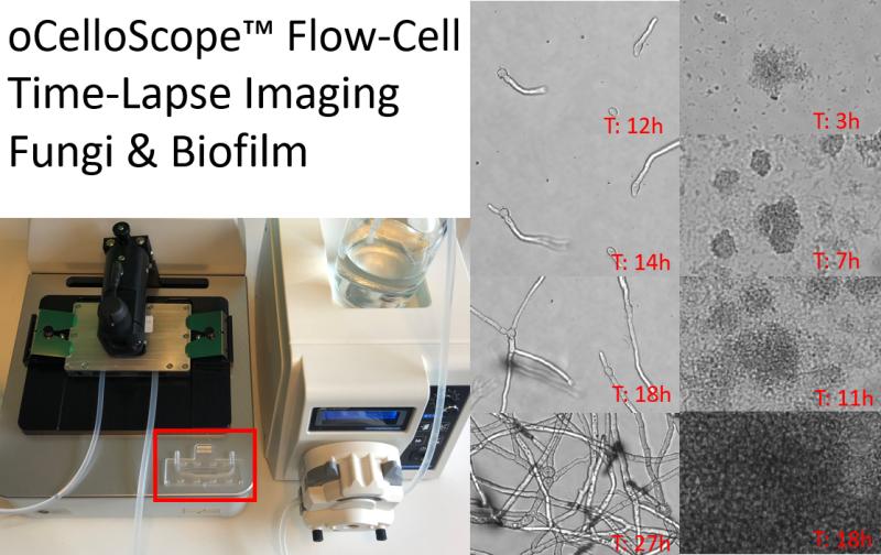 Flow-cells w/ oCelloScope to study non-static kinetics and morphology ...