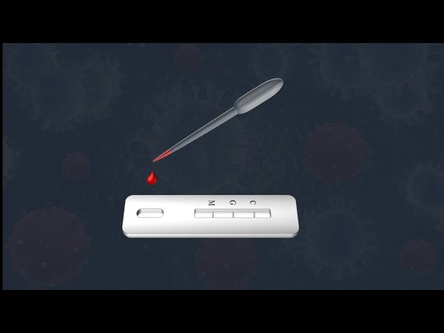 Coronavirus Antibody Test & Real time RT-PCR - Animation video : 이앤씨바이오