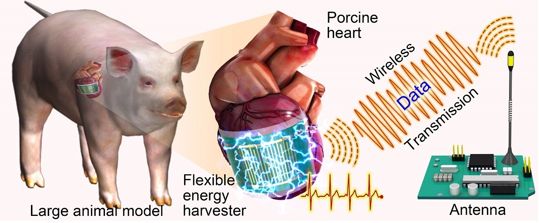 In Vivo Self-Powered Wireless Transmission Using Biocompatible Flexible ...