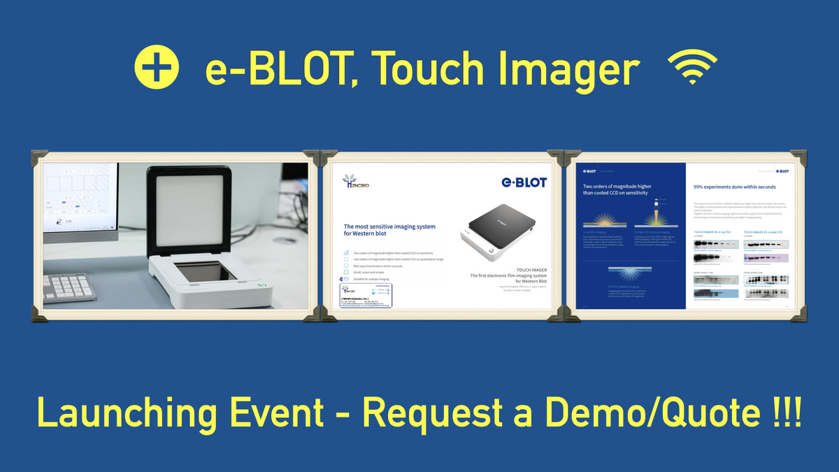 e-BLOT, Touch Imager, Western Blot Imaging System [ 기기 데모 신청 가능 ] : Recomninase Polymerase ...