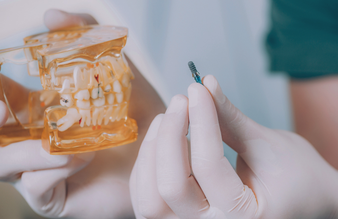 Global Premium Dental Lab - DENTLINK