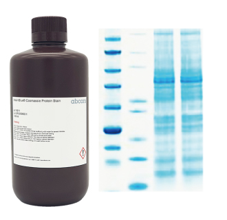 [Abcam] InstantBlue, Protein ladder 15% 할인 행사 (~12/28) : 할인행사 및 각종 Event