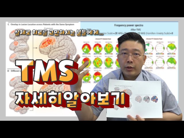 TMS가 효과적인 정신질환은? - TMS 바로알기 How to conjugate TMS effectively : EASYBRAIN