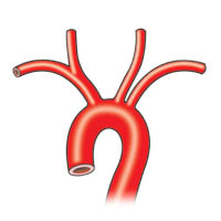 Aortic arch type 1 : INFOGRAPHY (인포그라피)