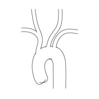 Aortic arch type 1 : INFOGRAPHY (인포그라피)