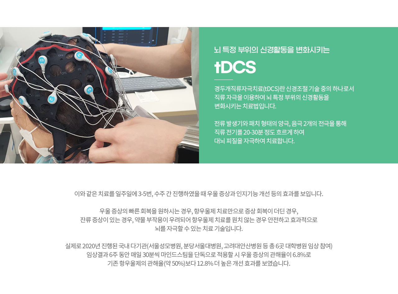rTMS / tDCS