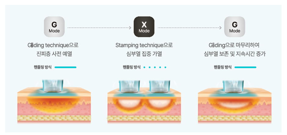 EBD(Energy-Based Device)시장의 Top-Tier “올리지오X(OligioX)” 탄생!! : 원텍 WONTECH