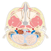 Pons/pontine region (superior) : INFOGRAPHY (인포그라피)