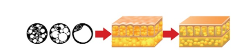 Are Fat-Dissolving Injections Permanent? : Medi-fella | Blog
