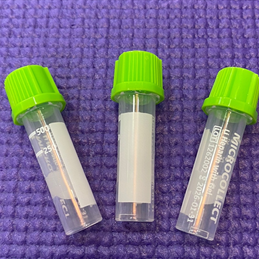 [1.2,3,4차35만개 완판.5차 10만개입고] [ 아이덱스 idexx 소모품관] 카탈리스트 tip, sample cup ...