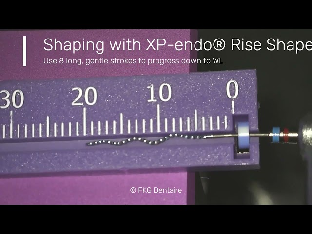 [FKG] XP-endo Rise "Initial Treatment" Tutorial : FKG Swiss endo ...