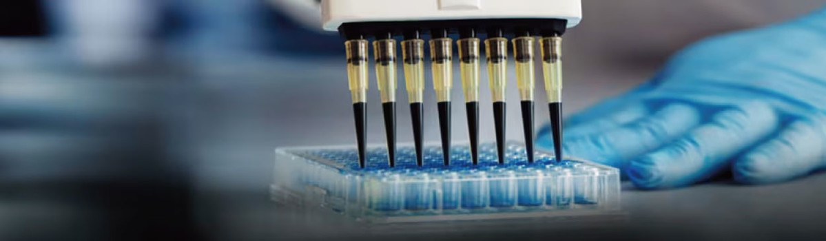 SimpleStep ELISA® kit, 보다 다양한 타입으로 만나보세요! : Abcam 제품 소개