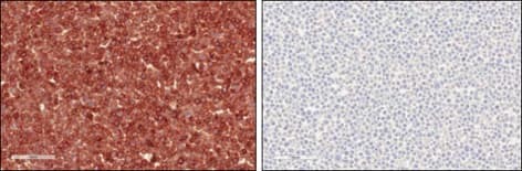 Immuno-oncology(IO) 연구 tool : Abcam 제품 소개
