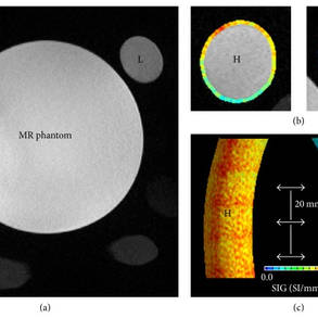Direct Assessment of Wall Shear Stress by Signal Intensity Gradient ...
