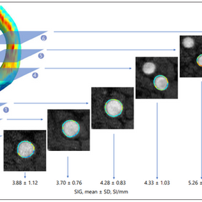 Association of Carotid Artery Endothelial Signal Intensity Gradient ...