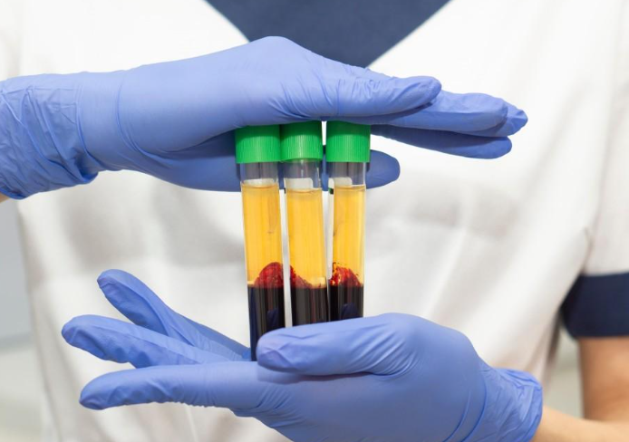 PRP vs. Exosome Skin Boosters: Which One Is Right for You? : Medi-fella ...