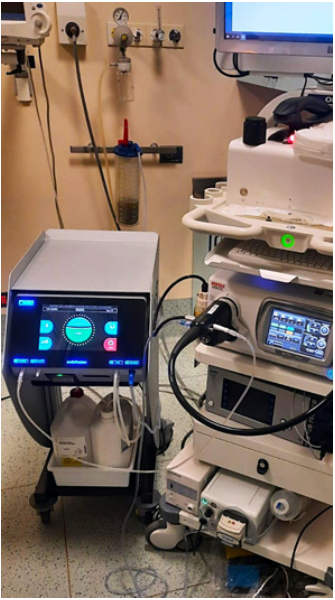 Real-Time Gastric Juice Analysis to Rule Out the Presence of Autoimmune ...