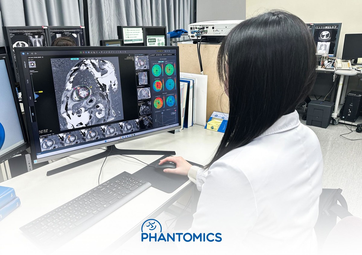 Phantomics Supplies AI-Powered Cardiac MRI Analysis and Diagnosis ...