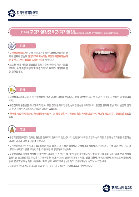 구강작열감증후군(혀작열감)(Burning Mouth Syndrome, Glossopyrosis) : 바를연한의원 - 다빈도 상병 자료실