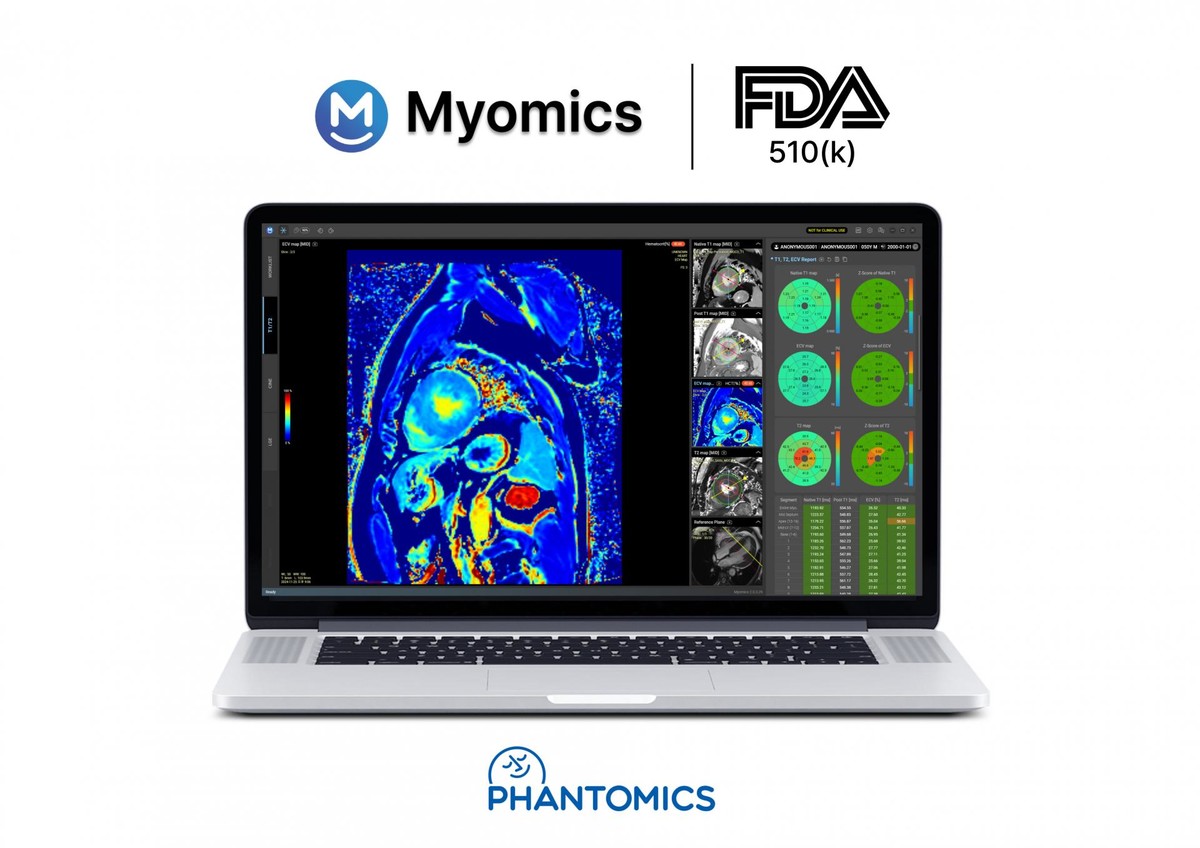 Phantomics Secures FDA 510(k) Clearance for Enhanced AI-Powered Cardiac MRI Solution 'Myomics ...