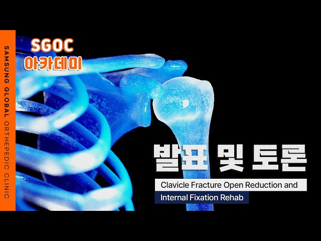 Clavicle Fracture Open Reduction and Internal Fixation Rehab : 대구 삼성글로벌 ...