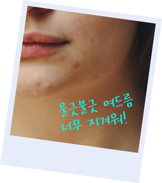 더마그램