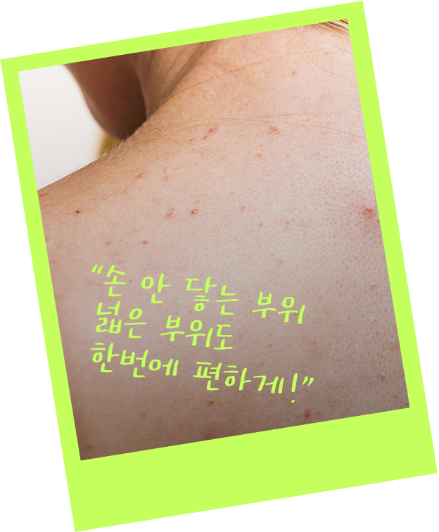 더마그램