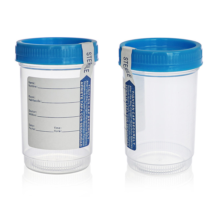 Specimen container for microbiology / urinalysis / histology ...