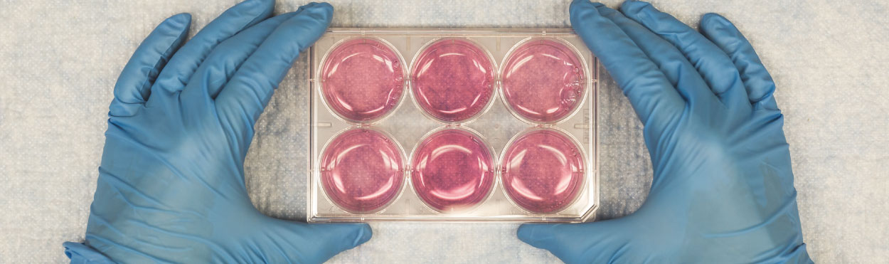 Mycoplasma 예방 및 제거 제품 : Invivogen 제품 소개