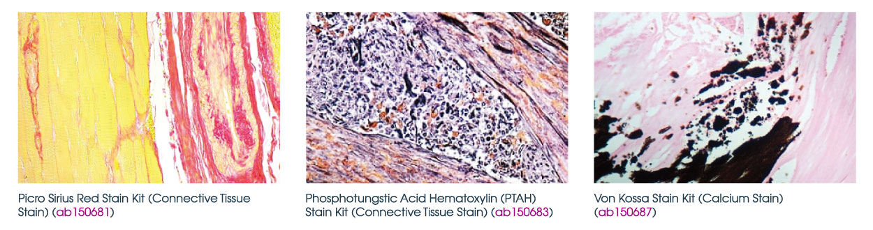 IHC (immunohistochemistry) 관련 제품 안내 : Abcam 제품 소개
