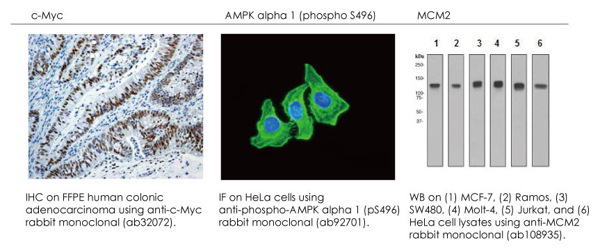 RabMAb® (Rabbit Monoclonal Antibody)의 장점 : Abcam 제품 소개