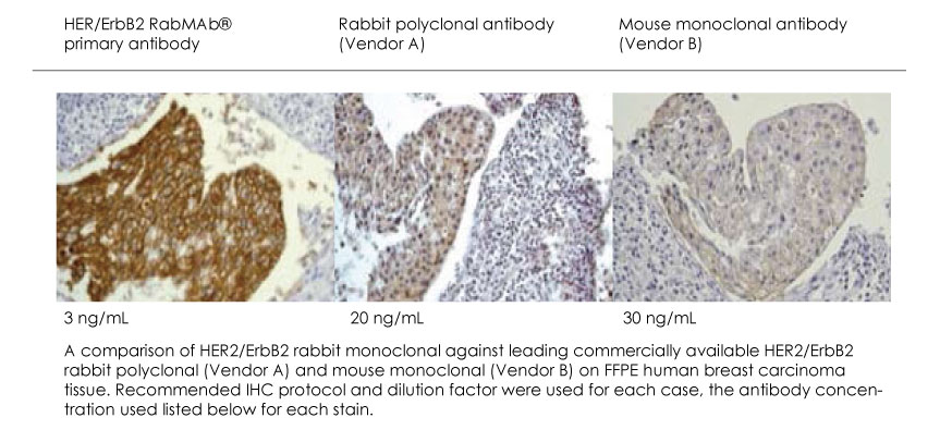 RabMAb® (Rabbit Monoclonal Antibody)의 장점 : Abcam 제품 소개
