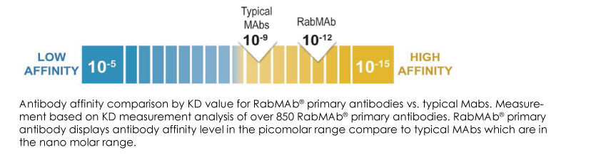 RabMAb® (Rabbit Monoclonal Antibody)의 장점 : Abcam 제품 소개