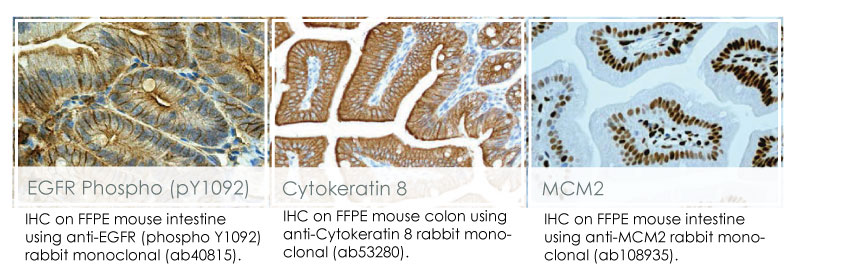 RabMAb® (Rabbit Monoclonal Antibody)의 장점 : Abcam 제품 소개