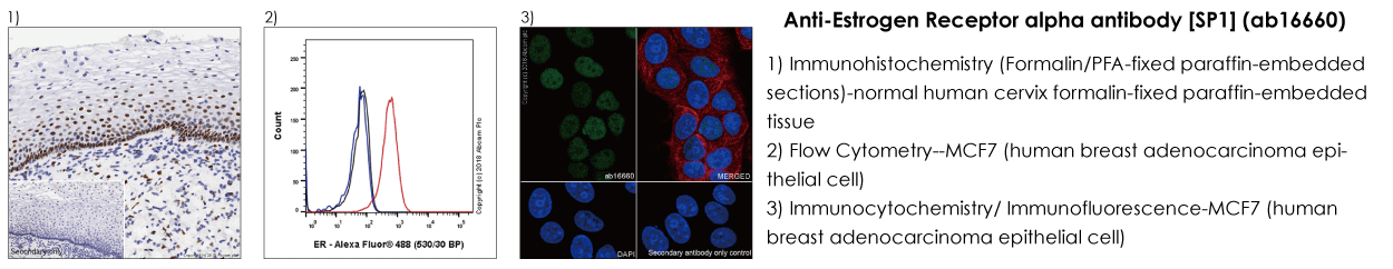 RabMAb[SP clone] 1ml 용량 출시! : Abcam 제품 소개