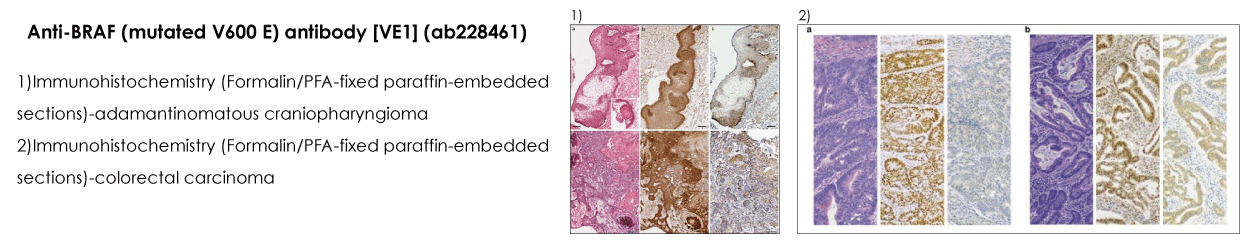 RabMAb[SP clone] 1ml 용량 출시! : Abcam 제품 소개