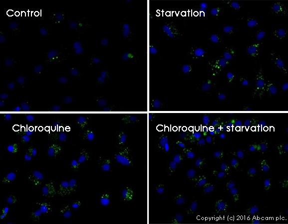 Autophagy Assay Kit : Abcam 제품 소개