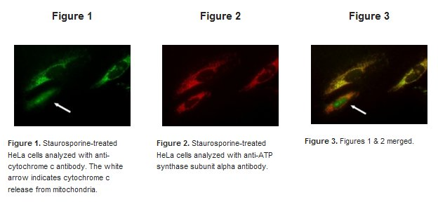 Apoptosis 연구를 하시나요? abcam 에서 제공하는 다양한 Solution 을 확인하세요! : Abcam 제품 소개