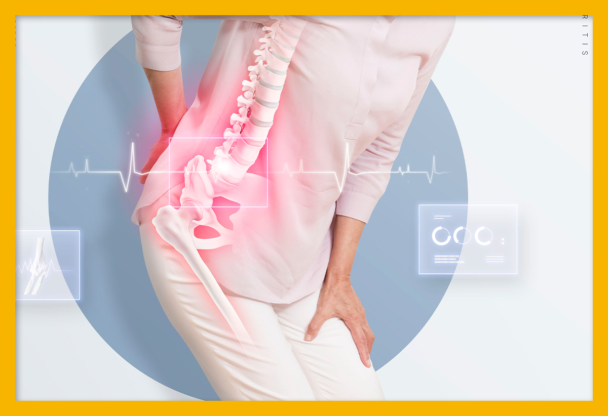 [오팔몬정] 혈액순환, 허리통증, 척추관협착/ 효능, 성분, 첨가제, 용량, 복용법, 주의사항 : 네이버 블로그