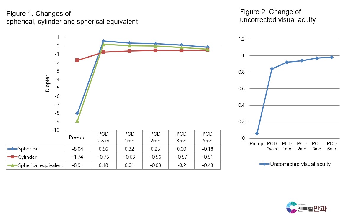 초고도근시 환자에서 TECHNOLAS® TENEO™ 317 Model 2 M2 excimer laser를 이용한 굴절교정레이저 ...