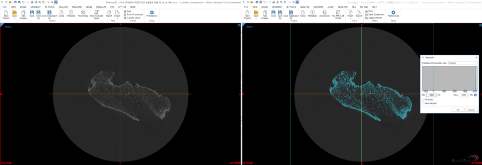 [Mimics 활용사례] "익산쌍릉 출토 인골"의 3D데이터 모델링과 복제품을 3D프린팅한 사례 (with 국제부여문화재연구소 ...