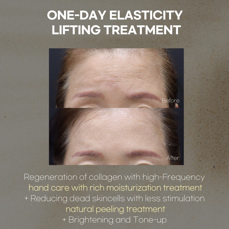 Brilliant Lifting Treatments for Different Skin Concerns : 광화문 리프팅은 라민의원