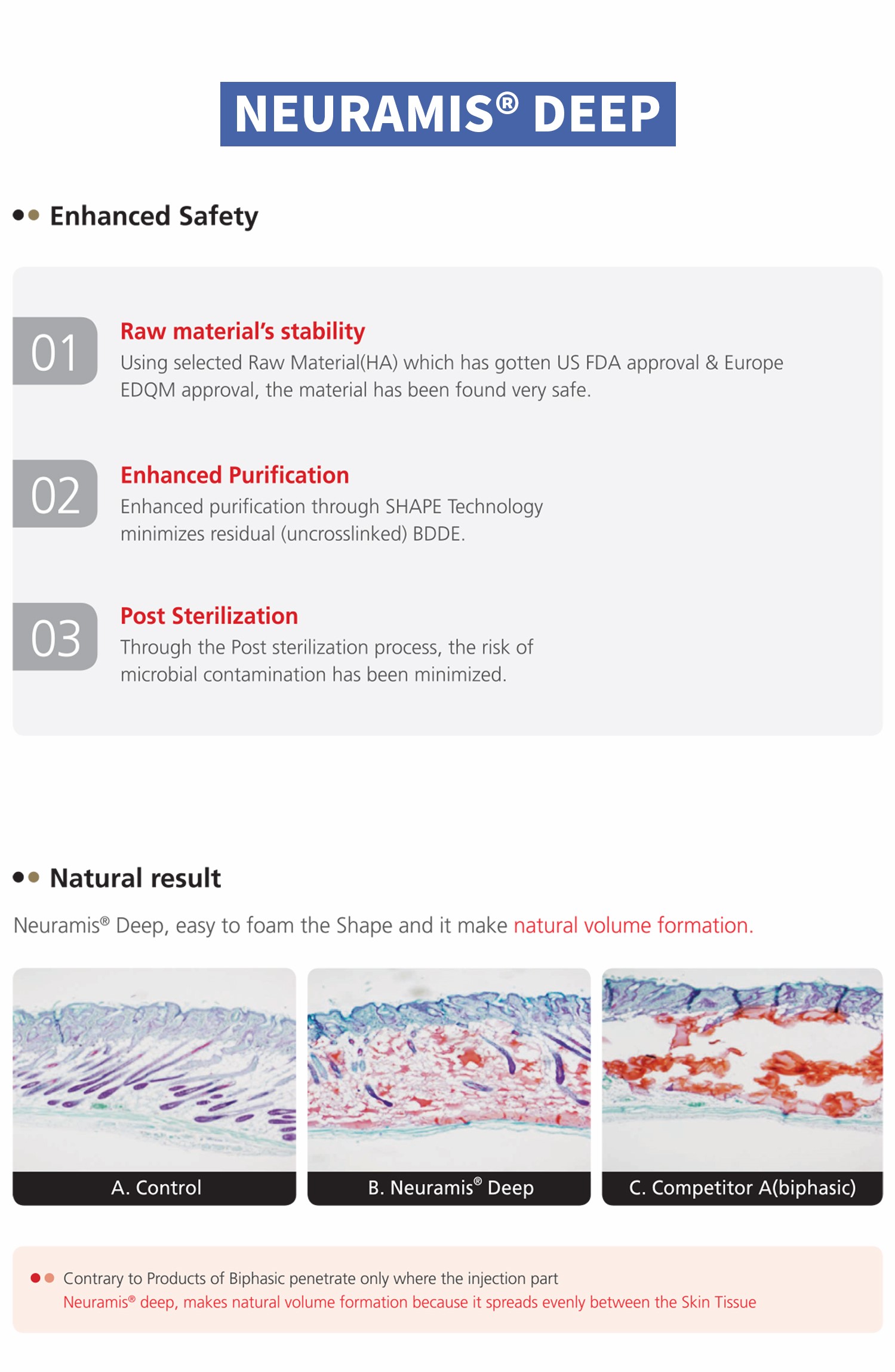 NEURAMIS Deep Lidocaine