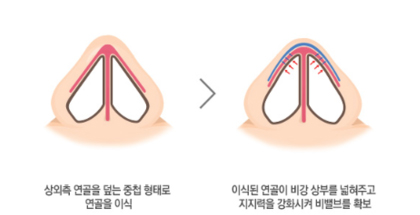 365코이이비인후과