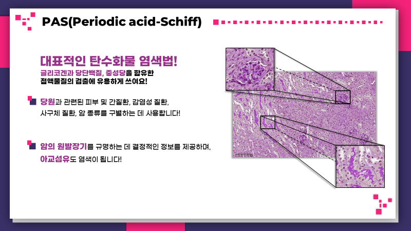 특수염색 소개 : Blog | 우당네트웍