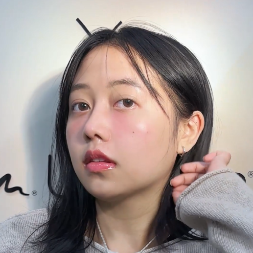 Non-Incisional Under-Eye Fat Repositioning: A Natural Solution for Dark ...