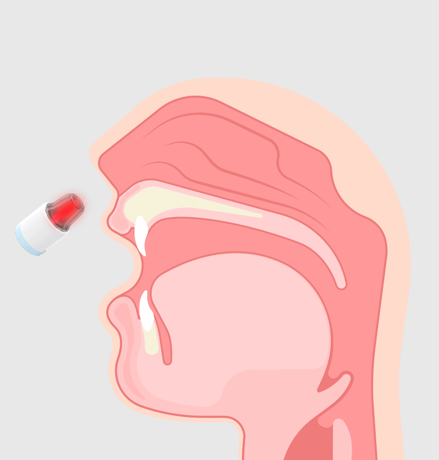 노즈굿 계절성 알레르기 비염치료 콧물 코막힘 재채기 국산 비염치료기 의료기기